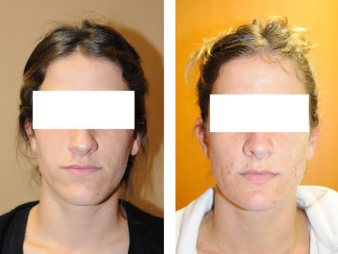 Traitement de l’Apnée du Sommeil à Paris et Neuilly | Témoignages